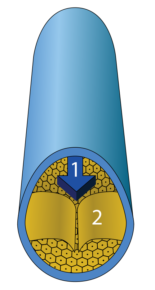Ekg clipart unlabeled, Picture #991513 ekg clipart unlabeled