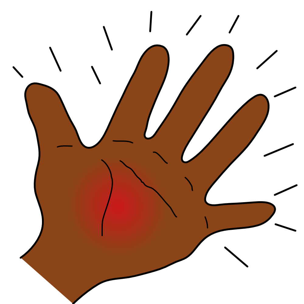 Hurt Clipart Swollen Picture 1384321 Hurt Clipart Swollen